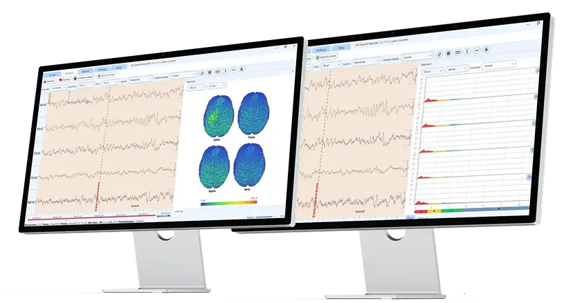EEG software for clinical research