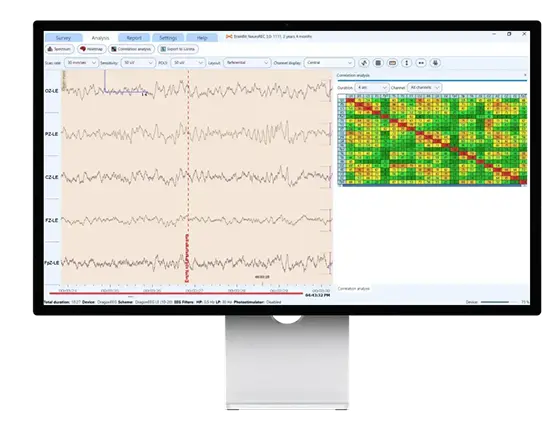 EEG software for clinical research