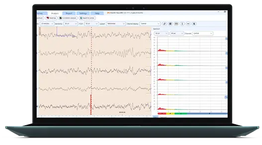 EEG software for clinical research